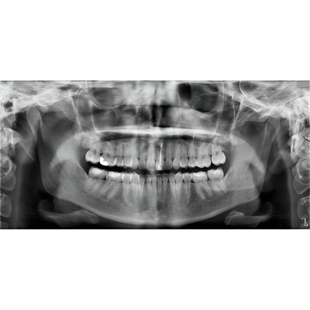 Panoramic – Global Imaging USA