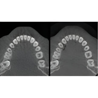 Carestream CS9600 Pan + CBCT (16x10 FOV) – Global Imaging USA