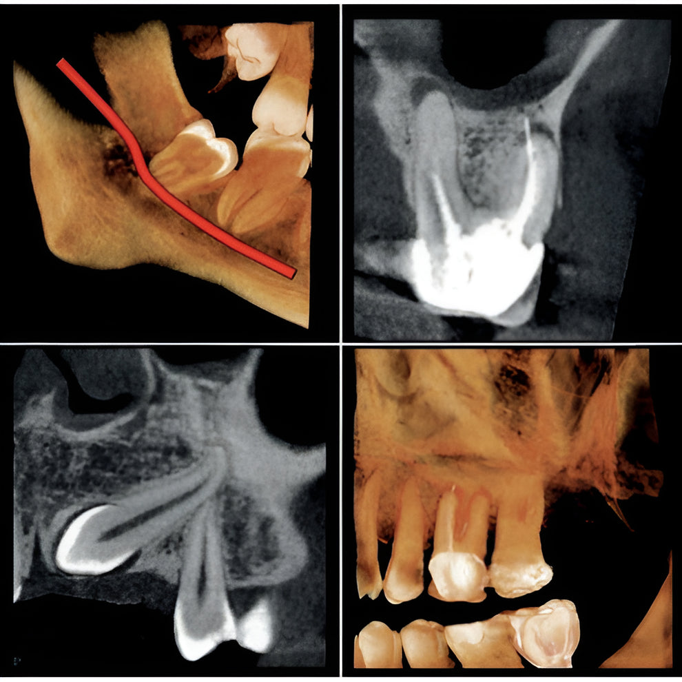 Dexis OP3D Pan + CBCT (FOV 9x14) – Global Imaging USA
