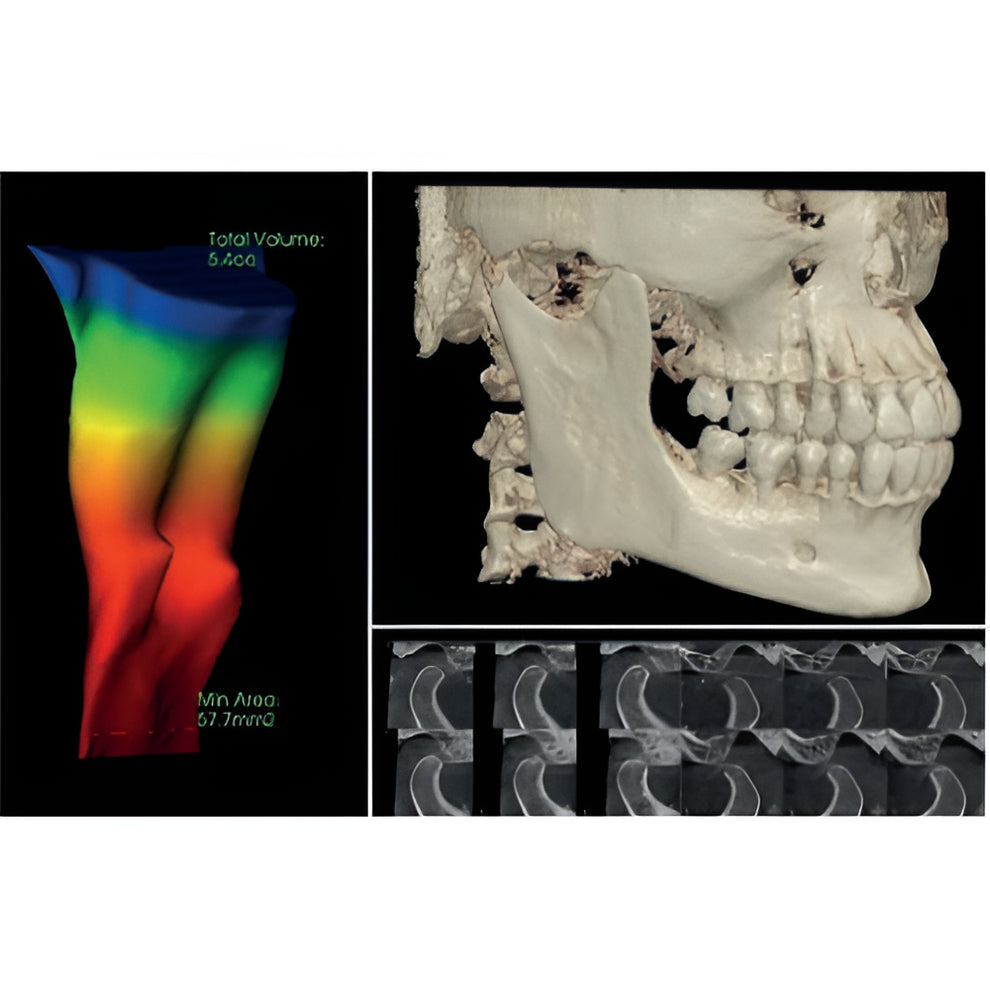 Dexis OP3D Pan + CBCT (FOV 9x14) – Global Imaging USA