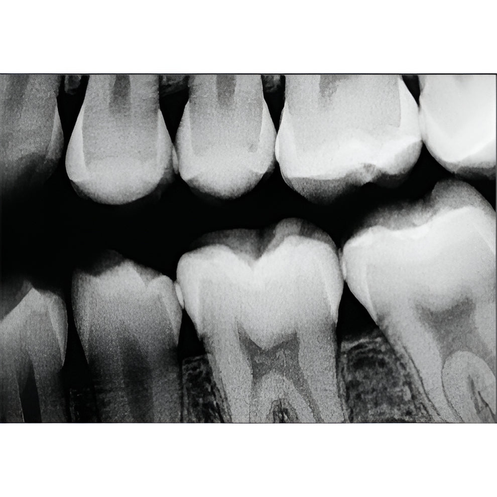 Schick CDR Elite Intra-Oral Sensor Size 2 with Warranty – Global ...